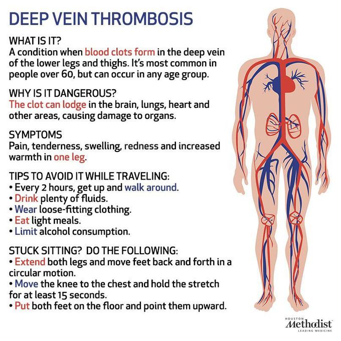 About DVT - MEDizzy