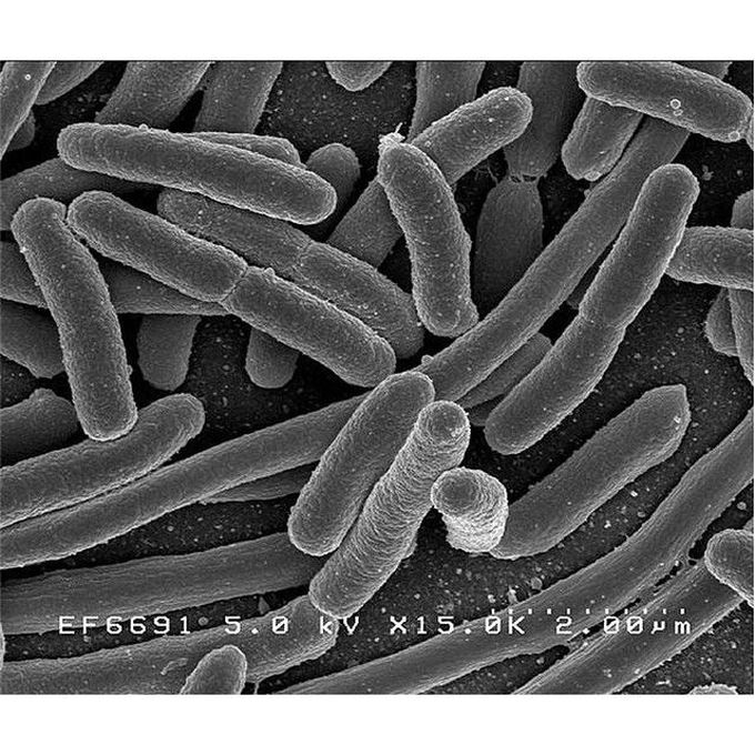 SEM image of Escherichia coli (E. Coli) bacteria - MEDizzy