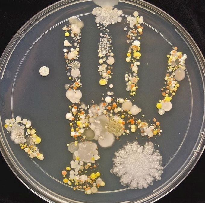 Microbes on 8 year old boy's handprints after playing - MEDizzy