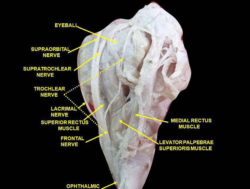 Extrinsic eye muscle. Nerves of orbita. Deep dissection. - MEDizzy
