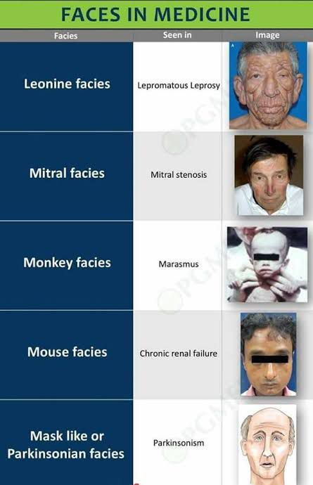 Facies Mitralis Skin Health: What It's Trying To Tell You About