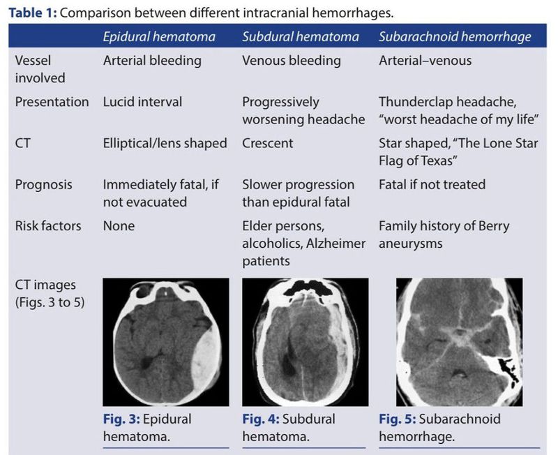 There Are Four Types Of Intracranial Hemorrhage Epidural Hematoma