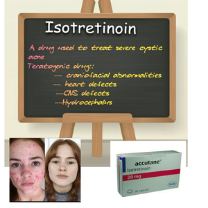 Isotretinoin - MEDizzy
