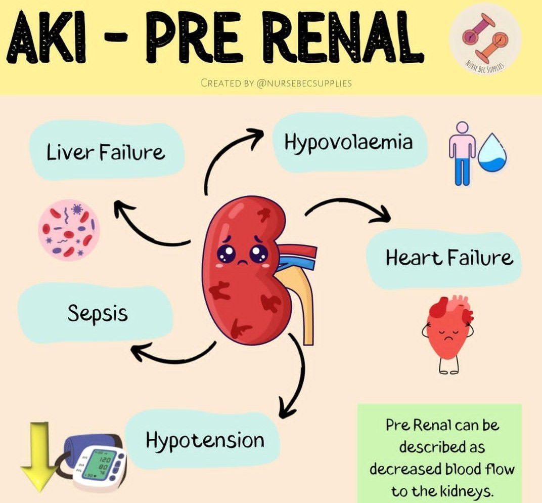 AKI Pre Renal MEDizzy