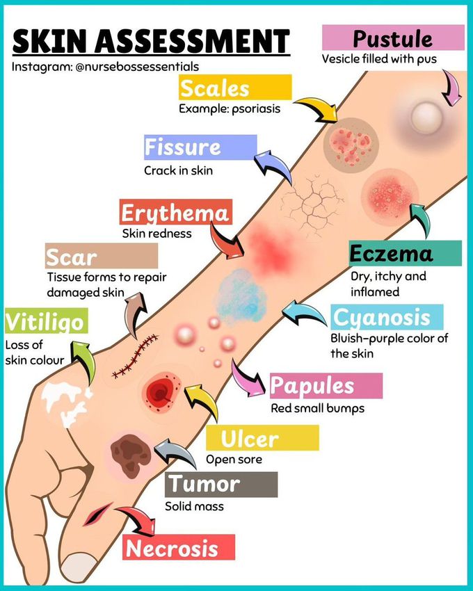 Skin Assessment - MEDizzy