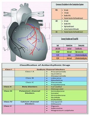 Coronary conduction - MEDizzy