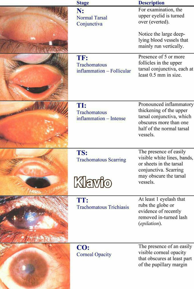 Pathaology of Eye - MEDizzy