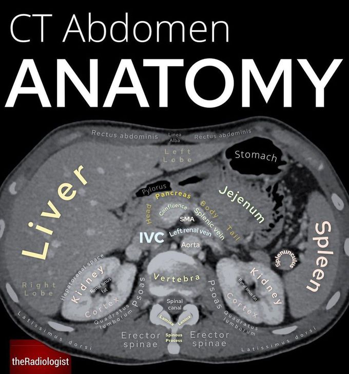 CT Abdomen - MEDizzy