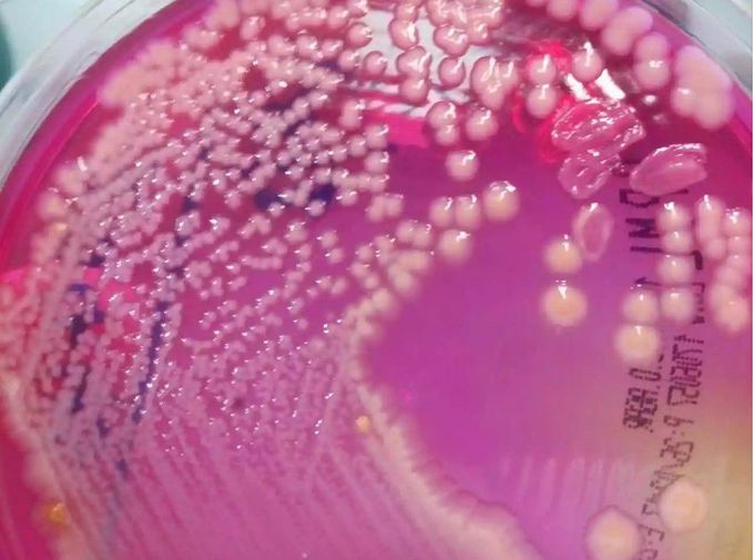 Identify the bacteria on XLD agar. - MEDizzy