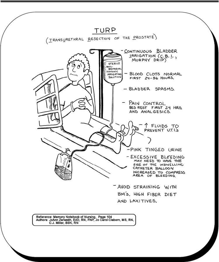Transurethral Resection Of The Prostrate TURP MEDizzy