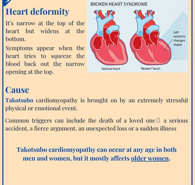 Broken Heart Syndrome II MEDizzy