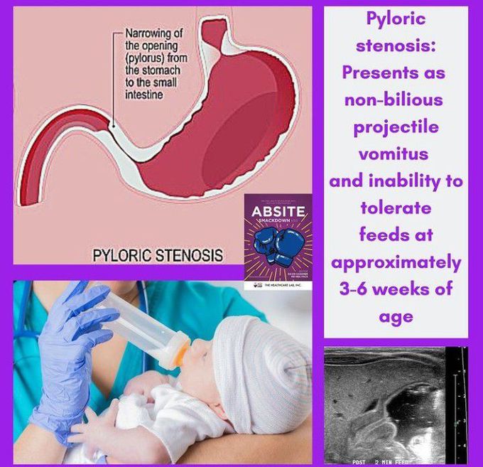 General surgery - MEDizzy