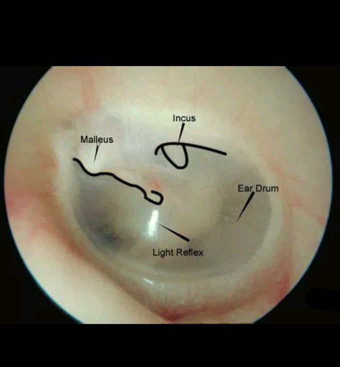 Tympanic membrane EAR - MEDizzy