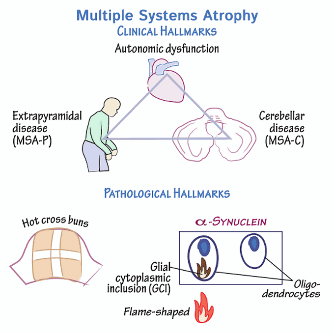 Multiple system Atrophy Symptoms - MEDizzy