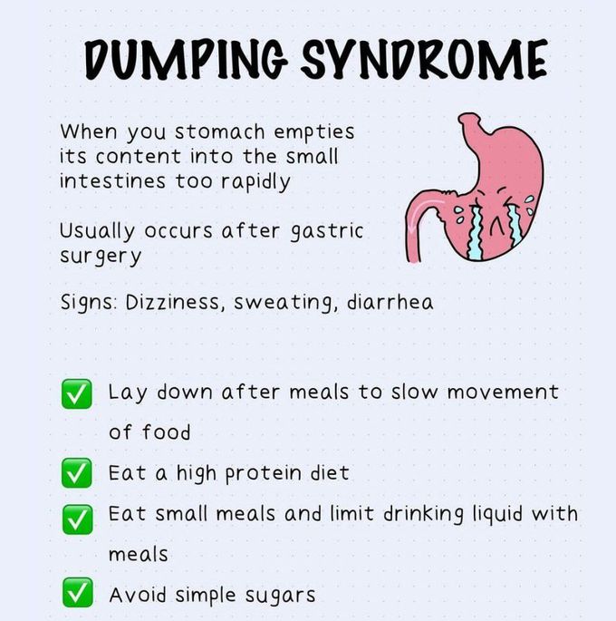 Dumping Syndrome - MEDizzy