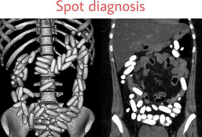 Spot Diagnosis - MEDizzy