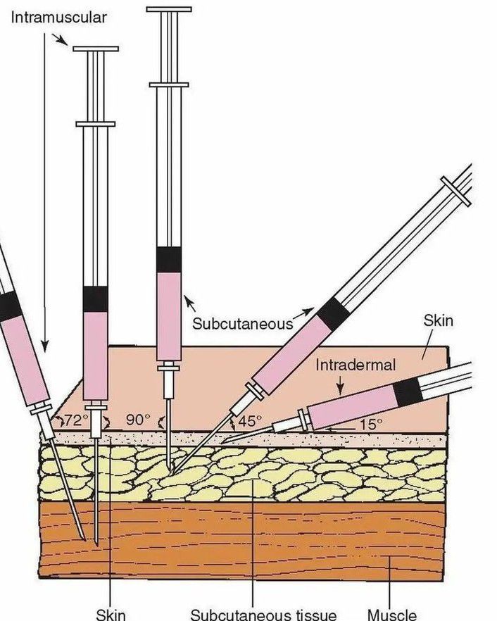 Routes of Administration - MEDizzy