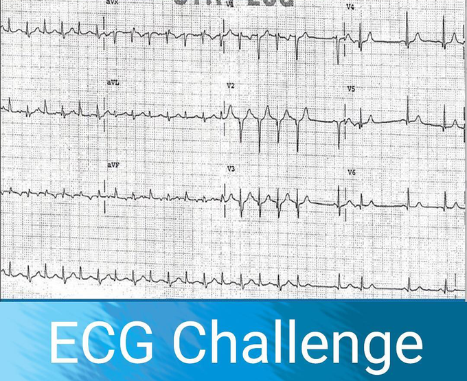 ECG Challenge - MEDizzy