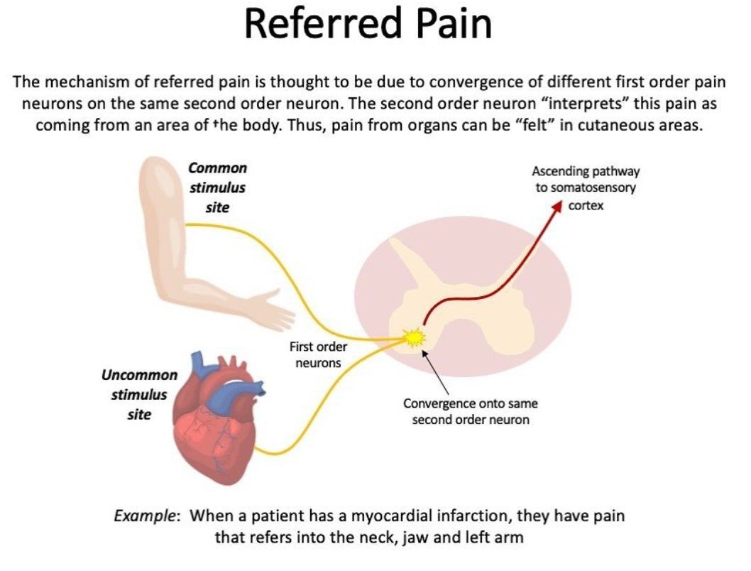 Examples Of Referred Pain