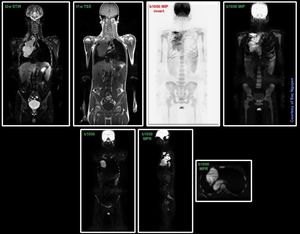wbDWI @ Siemens 3T Skyra. Performed direct coronal with - MEDizzy