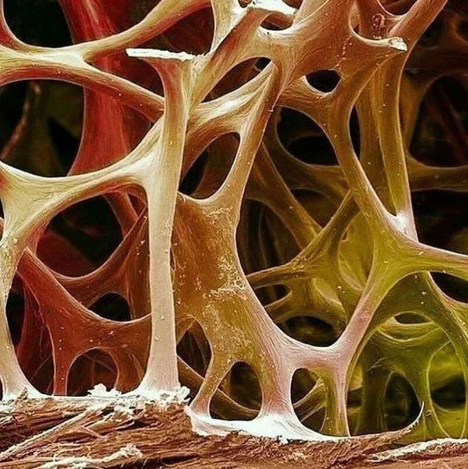 Inside thé bone - MEDizzy