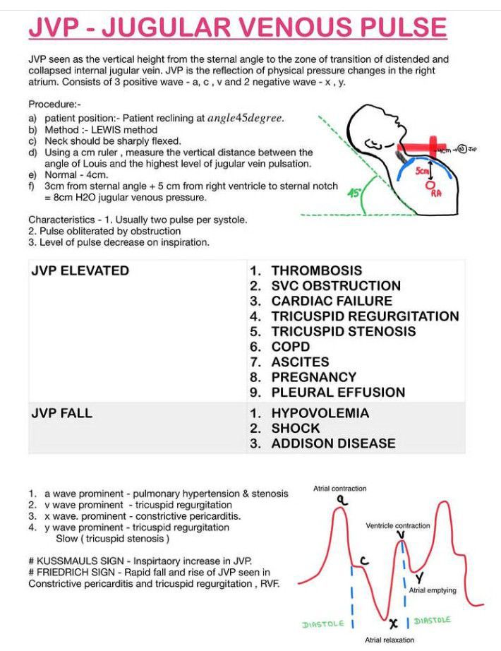 Jugular Venous Pulse MEDizzy