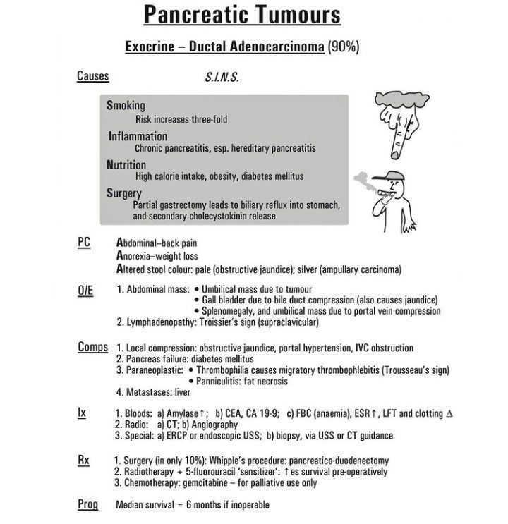 Pancreatic tumor - MEDizzy