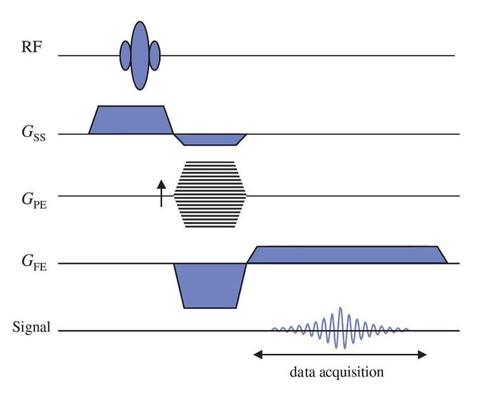 Basic gradient-echo (GRE) MR imaging sequence. GSS is the - MEDizzy