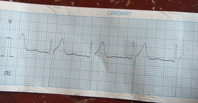 Care to comment? - MEDizzy