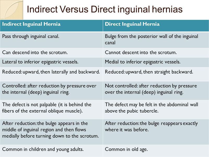 Inguinal Hernias Direct And Indirect Inguinal Hernias Types Of Hernia