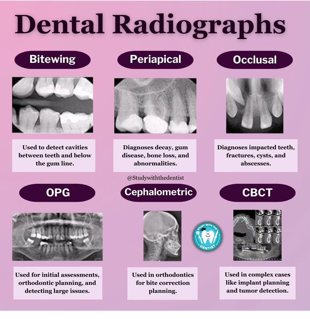 Dental Radiographs MEDizzy