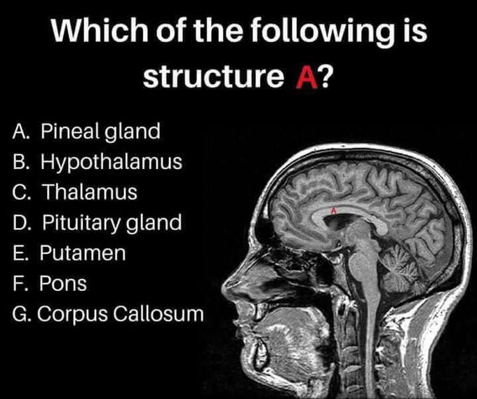 Ans- Corpus Callosum - MEDizzy