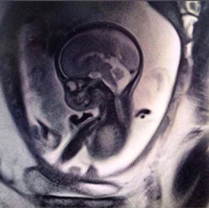MRI of a baby in utero!! - MEDizzy