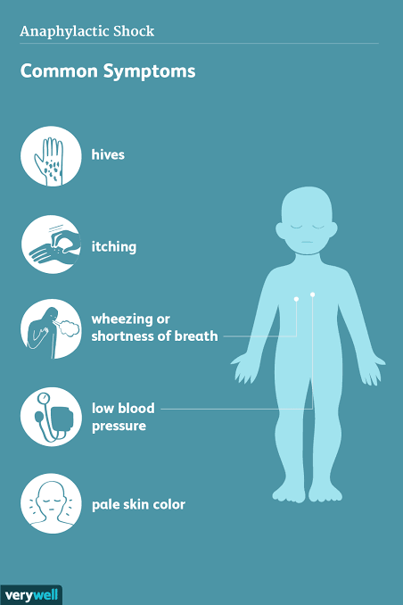 Symptoms of anaphylactic shock - MEDizzy