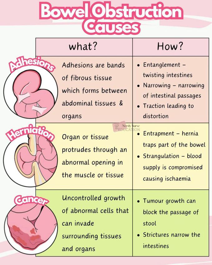 Bowel Obstruction - Causes - MEDizzy