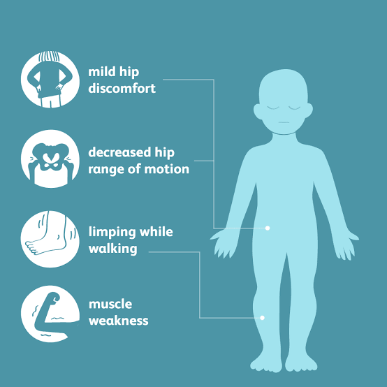 These are the symptoms of Legg calve perthes syndrome - MEDizzy