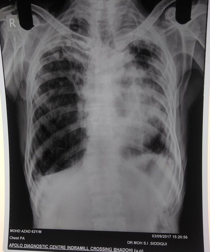 X-ray chest - MEDizzy