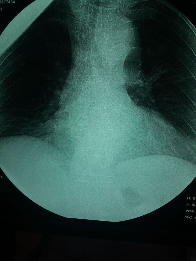 What are you see - MEDizzy