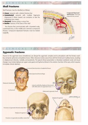Fracture skull - MEDizzy