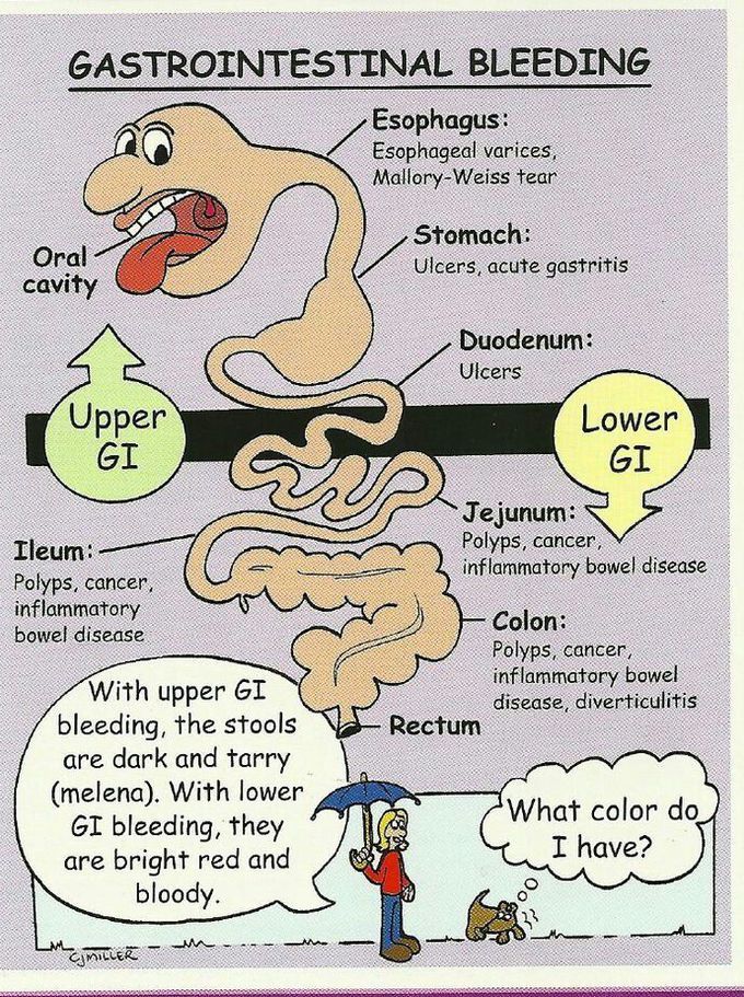 Bleeding from GIT - MEDizzy