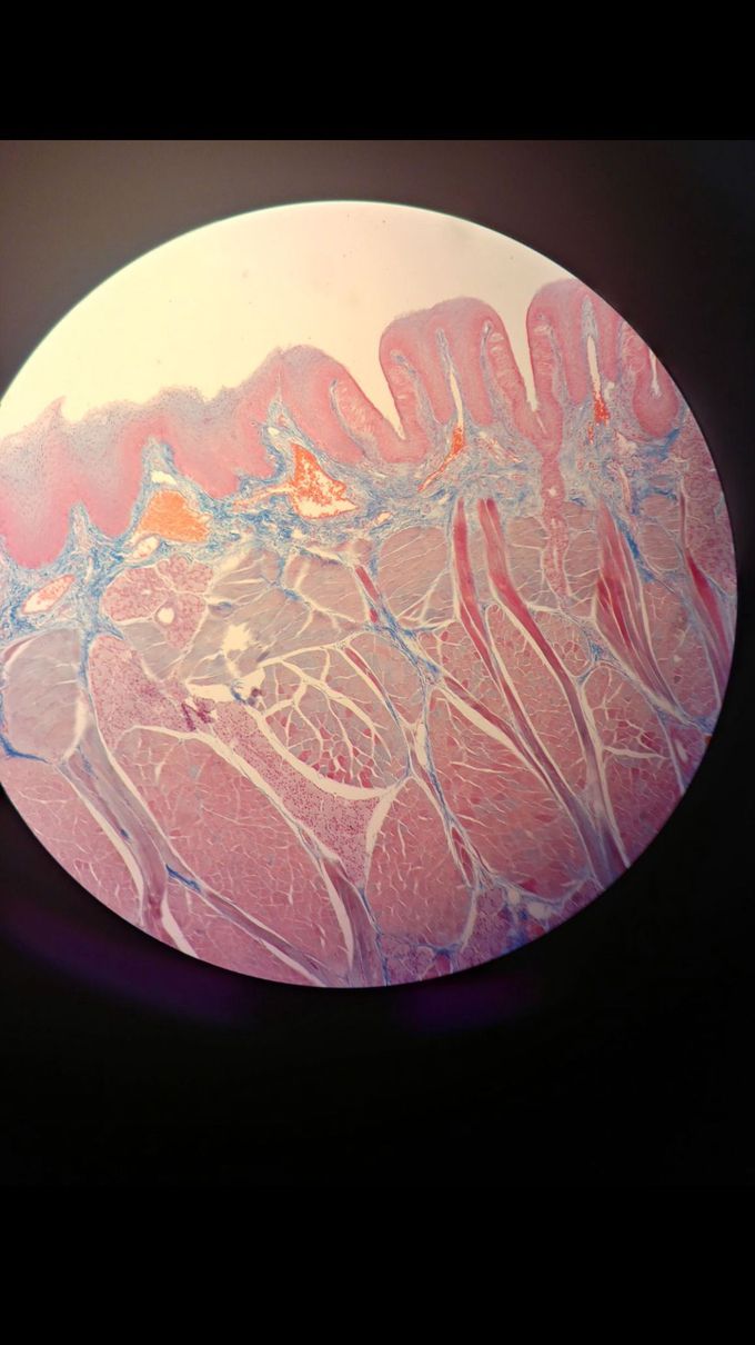 Tongue under the microscope - MEDizzy