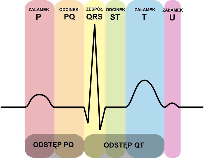 An intuitive ECG diagram - MEDizzy