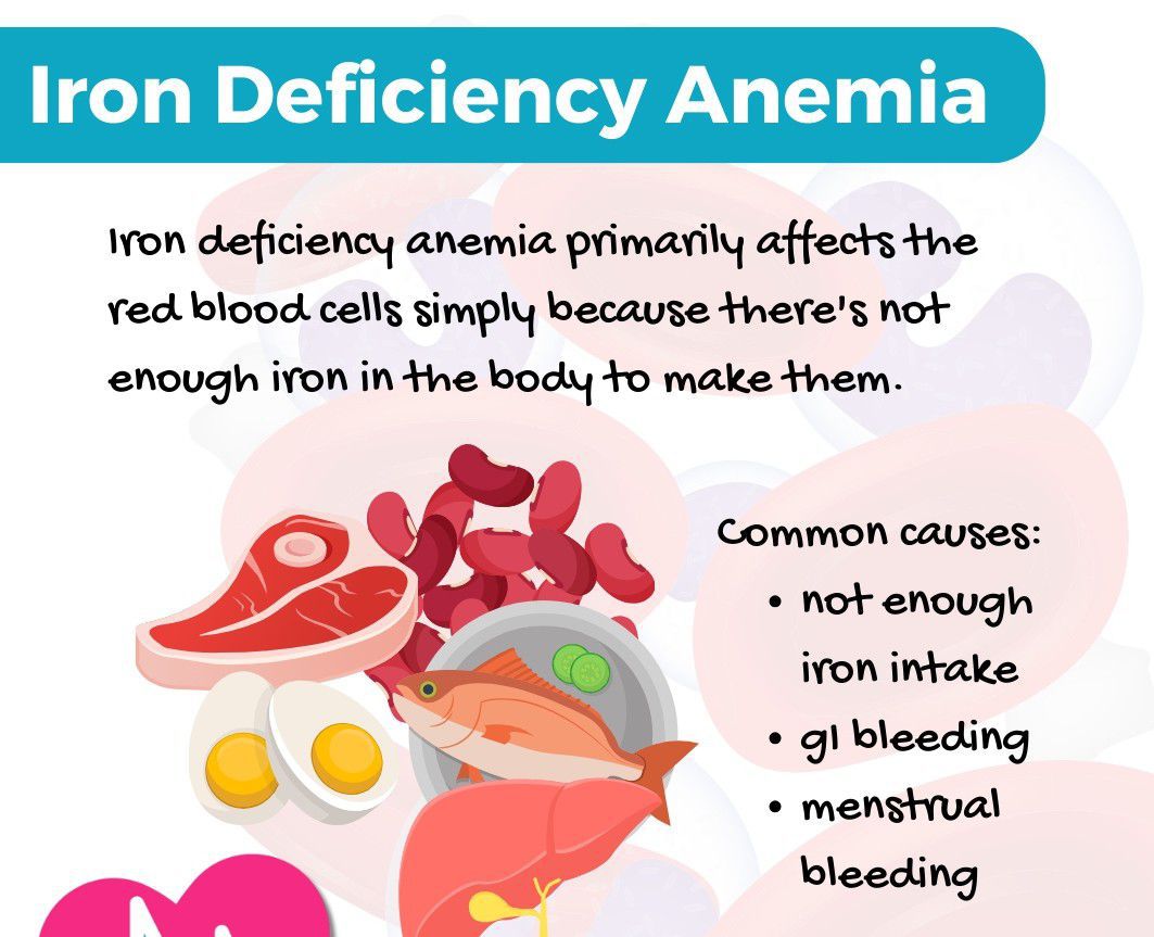 Iron Deficiency Anemia - MEDizzy