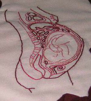 2day hard Work - MEDizzy