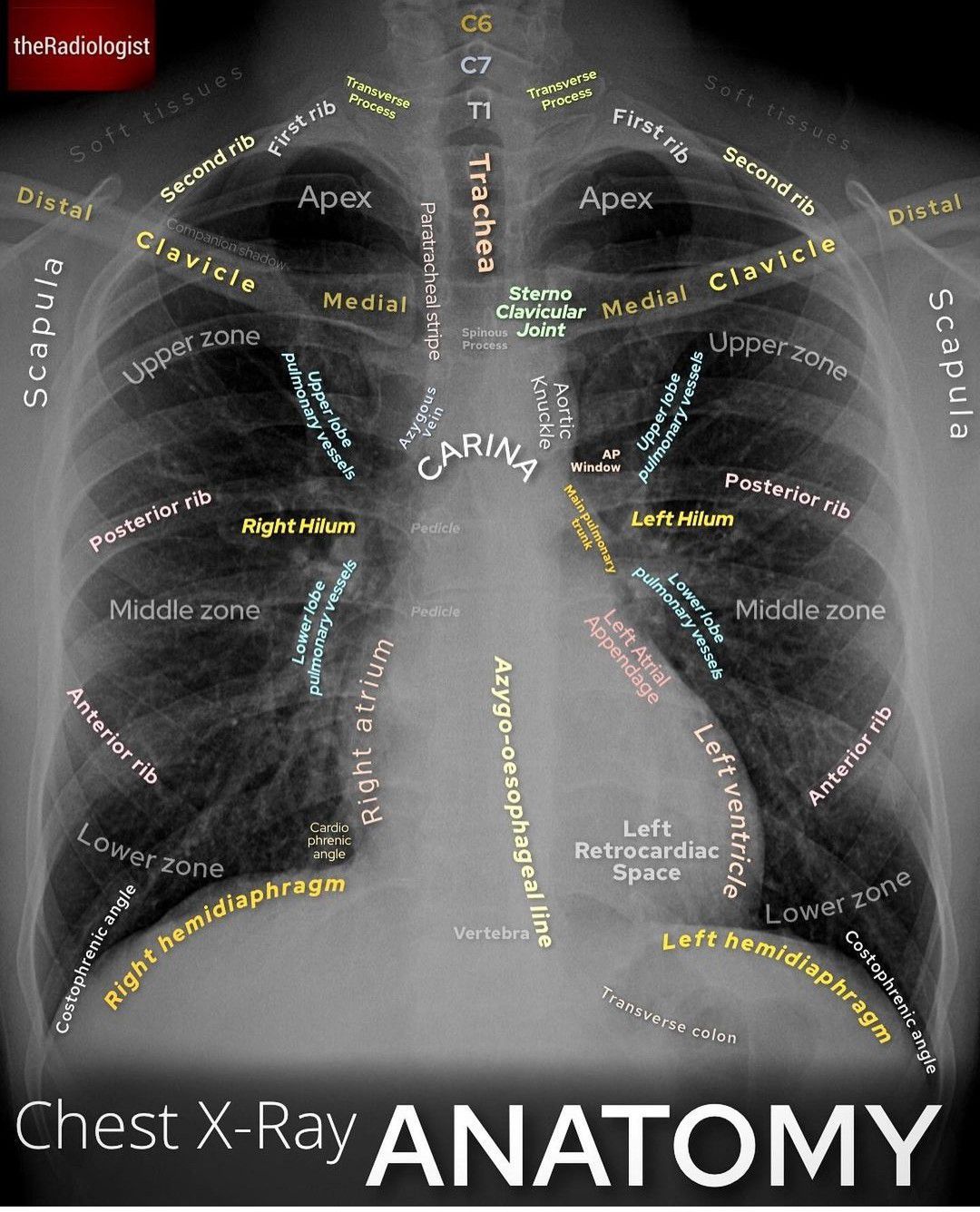Detailed Chest X ray Review MEDizzy