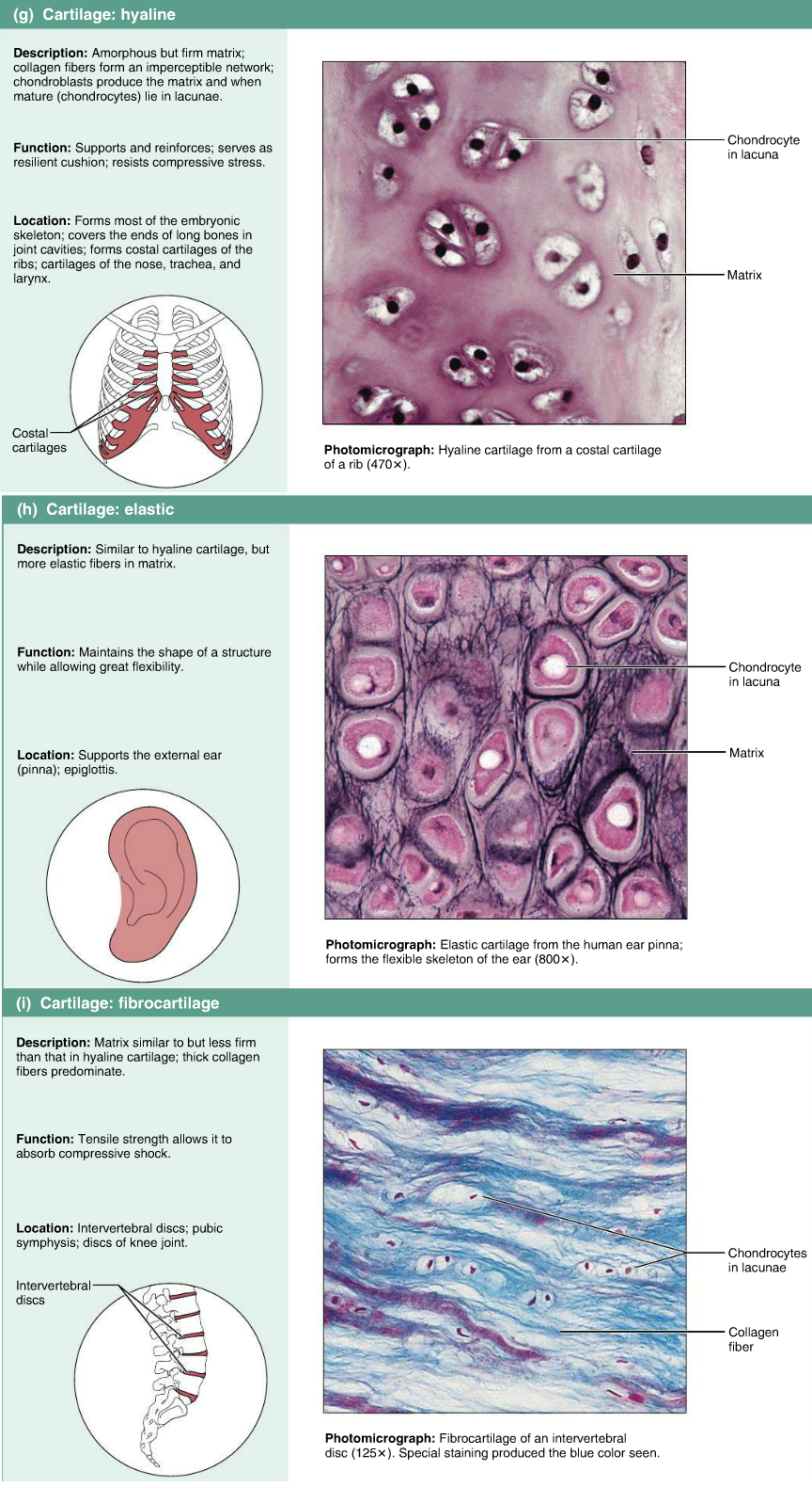 Types Of Cartilages MEDizzy