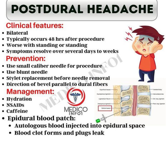 postdural headache - MEDizzy