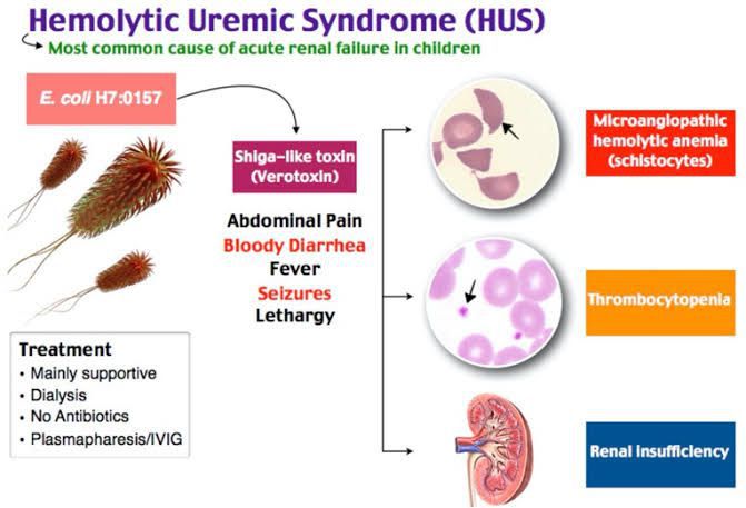 Hemolytic uremic syndrome symptom - MEDizzy
