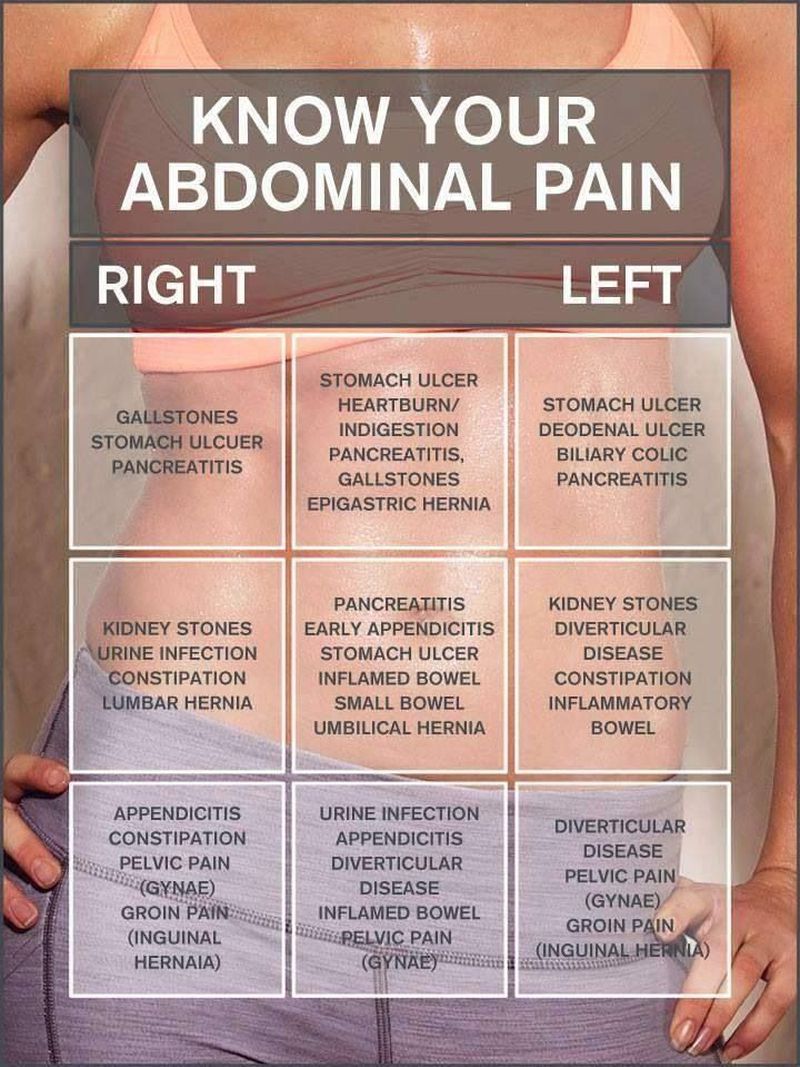 Stomach Pain Chart Pain Chart