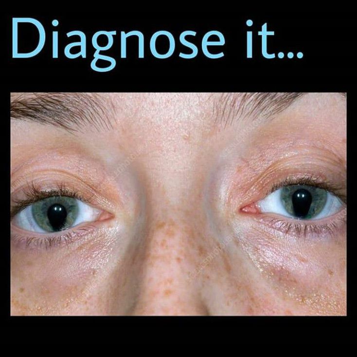 Diagnosis....!!!? - MEDizzy